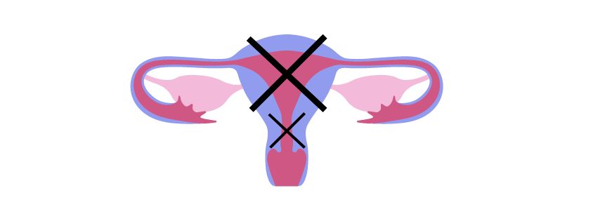 Types of Surgery – Surgical Menopause New Zealand Trust